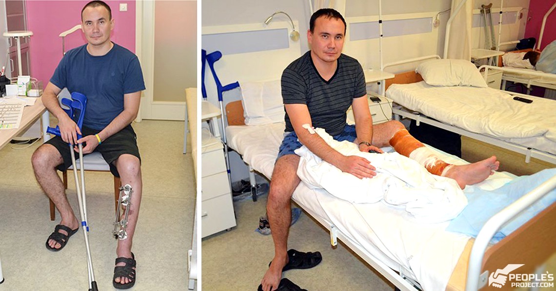 The Biotech's patient who nearly lost his leg, went home on his own two ...